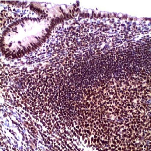 آنتی­ بادی INI1 (BAF47/SNF5) (25/BAF47) - شرکت سما تشخیص آریا