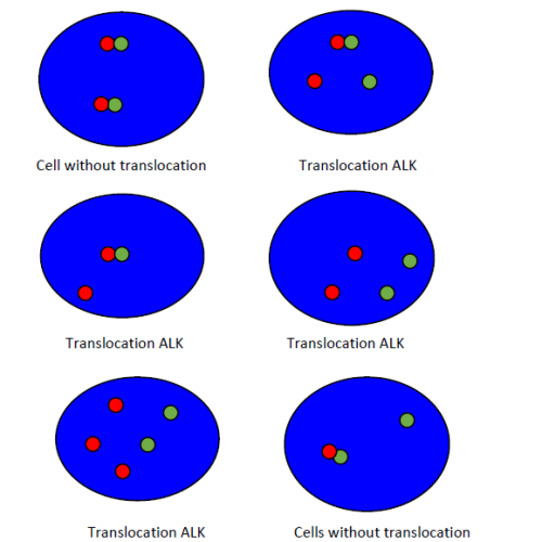 پروب فیش ALK Break Apart FISH Probe - شرکت سما تشخیص آریا